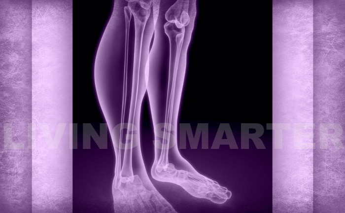 Fibromyalgia Leg Pain